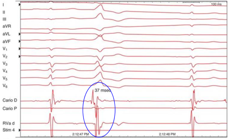 心事谁人知？ECG/PPG 穿戴式装置的机会与延伸测试 | 百佳泰 Allion Labs