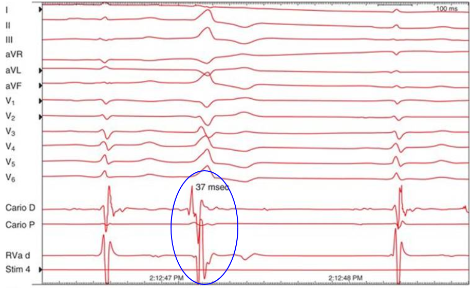 心事谁人知？ECG/PPG 穿戴式装置的机会与延伸测试 | 百佳泰 Allion Labs